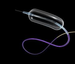 DeviceMD - HYPERFORM™ OCCLUSION BALLOON SYSTEMS