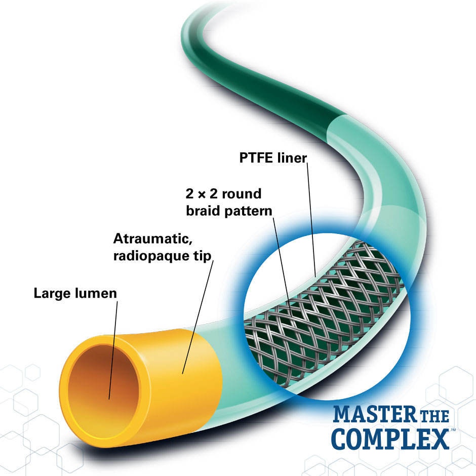 DeviceMD - MACH 1™ Guide Catheter