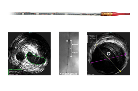 DeviceMD - Visions PV .035