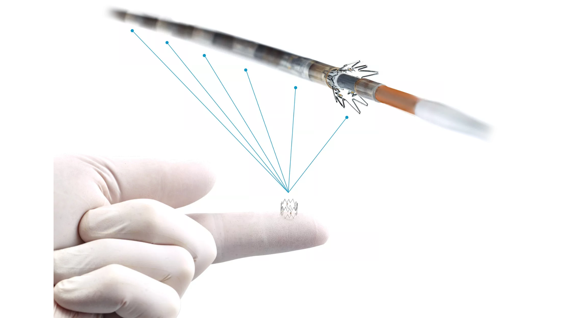 DeviceMD - Tack endovascular system