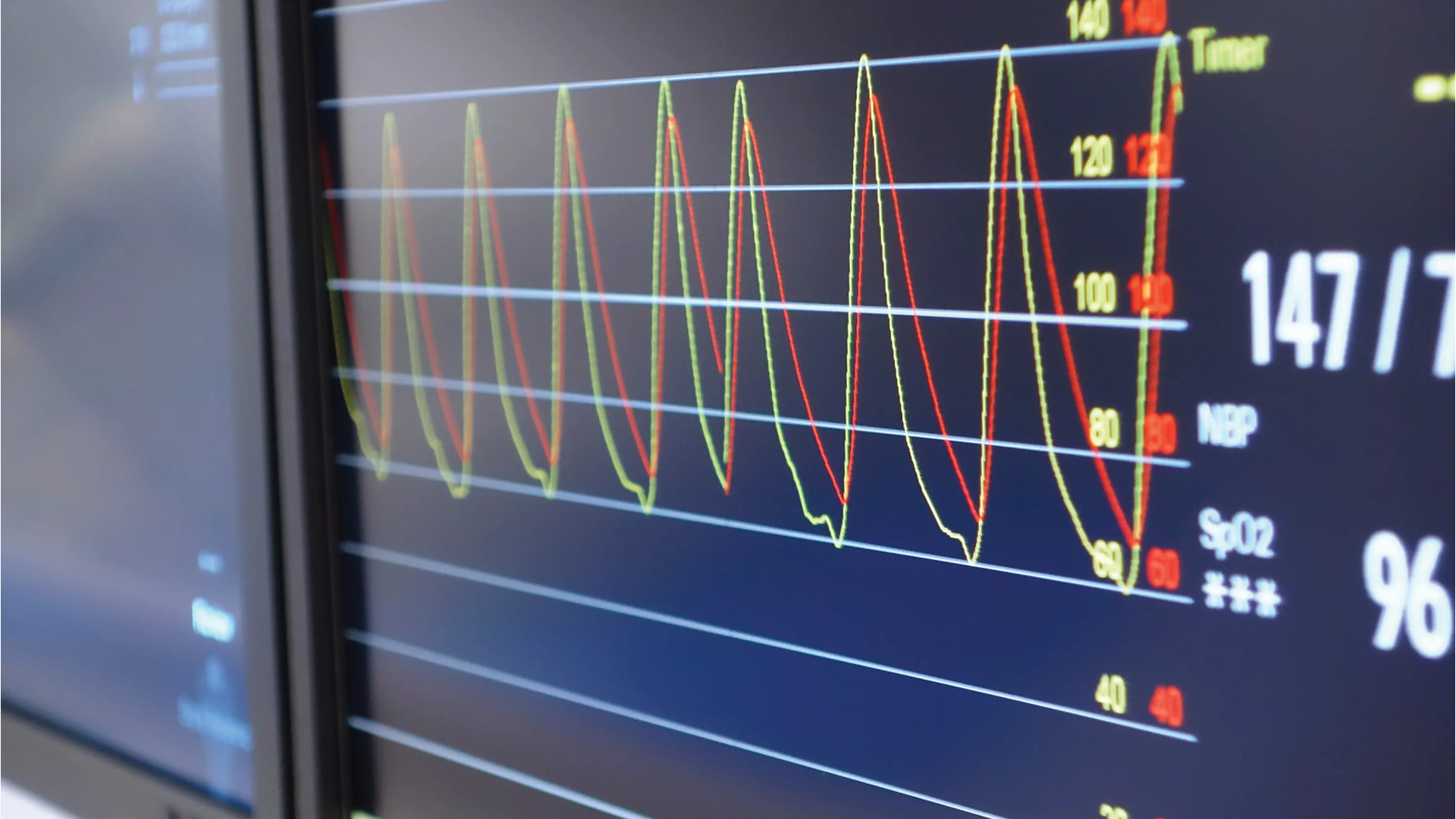DeviceMD - Verrata Plus Pressure guide wire